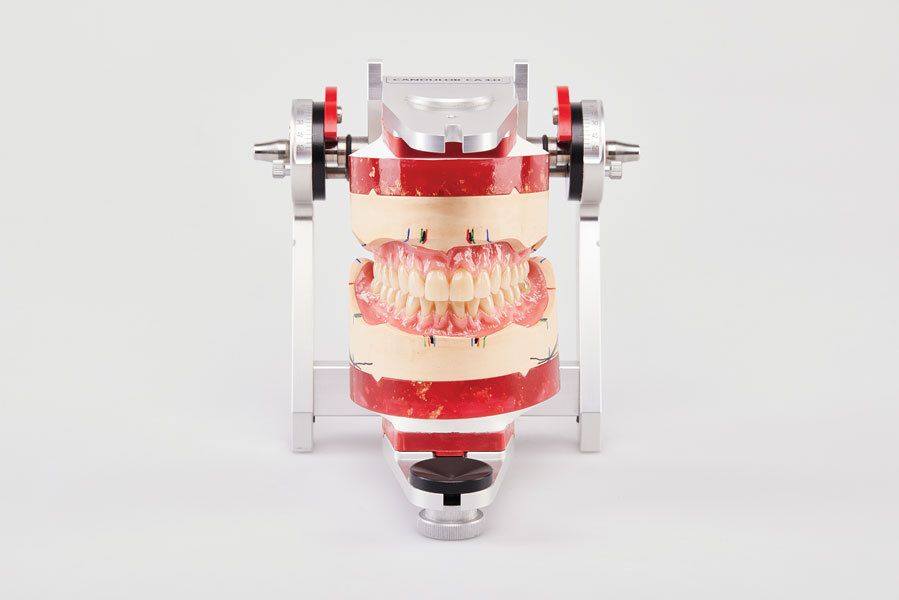 Full Denture Prosthetics: The Ultimate Discipline | Inside Dental ...