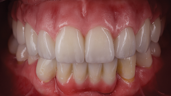 Using Collaboration and Technology to Deliver | Inside Dental Technology