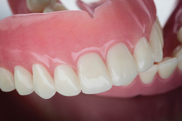 New Approaches to Removable Prosthetics | Inside Dental Technology