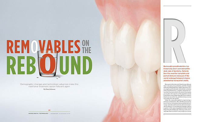 Removables on the Rebound | Inside Dental Technology