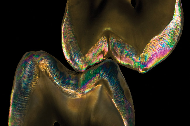 Advanced Technique for Achieving Exceptional Esthetics | Inside Dental ...