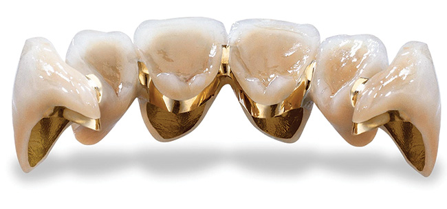 DENTSPLY Expands its Offerings | Inside Dental Technology