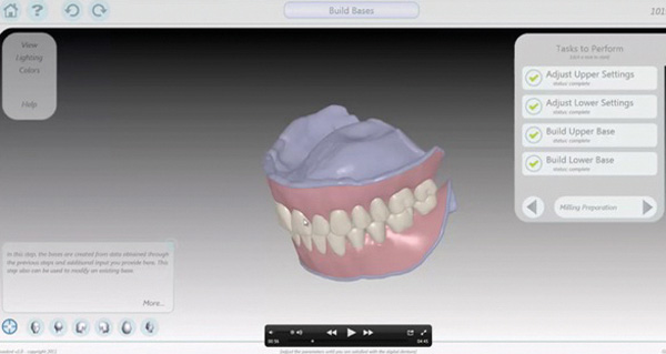 A New Frontier: Digital Dentures | Inside Dental Technology