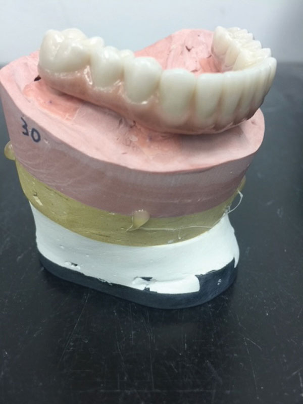 Software, Skill, and Intelligence | Inside Dental Technology