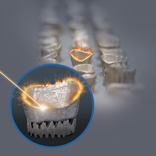 Argen Digital's High-Noble SLM Substructures | Inside Dental Technology