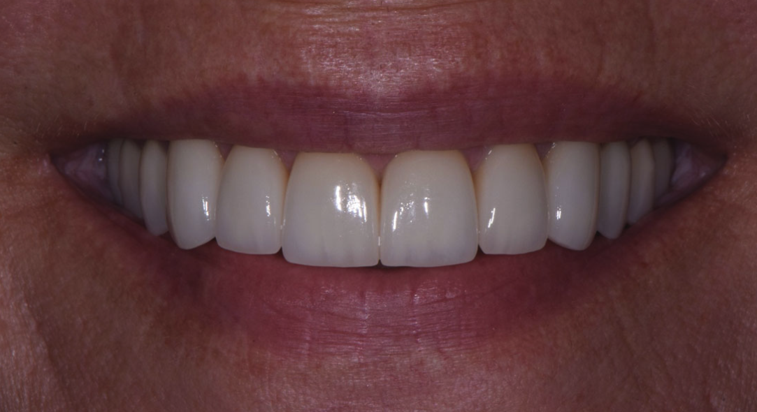 Redefining What Is Possible | Inside Dental Technology