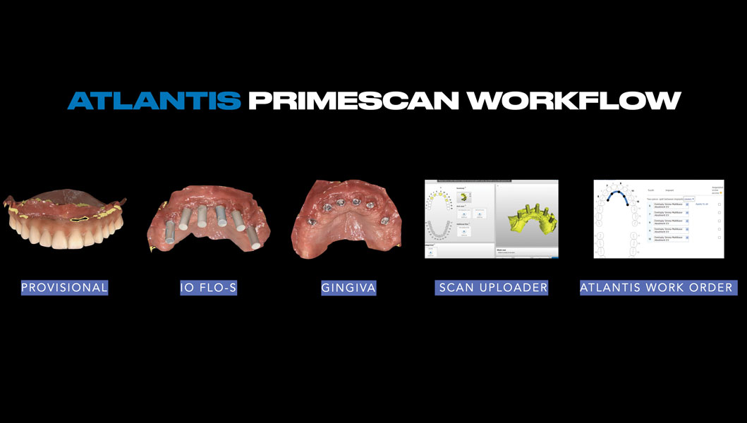 Using a Digital Workflow to Increase Efficiencies | Inside Dental ...