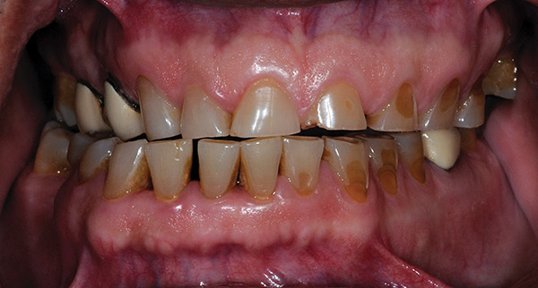 The New Face of Esthetic and Reconstructive Dentistry: Digital Design ...
