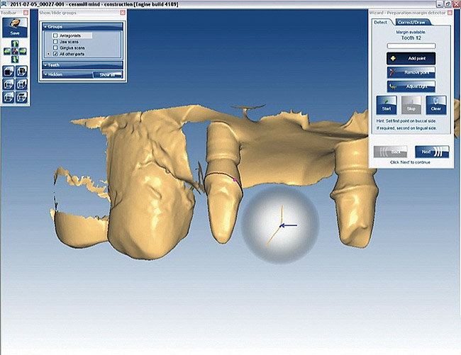 Make it Simple | Inside Dental Technology