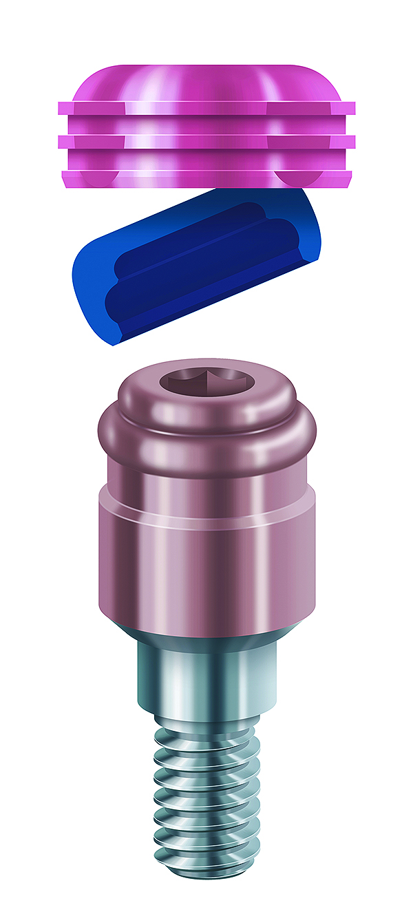 ZEST Anchors Introduces The Next Generation LOCATOR® - LOCATOR R-Tx ...