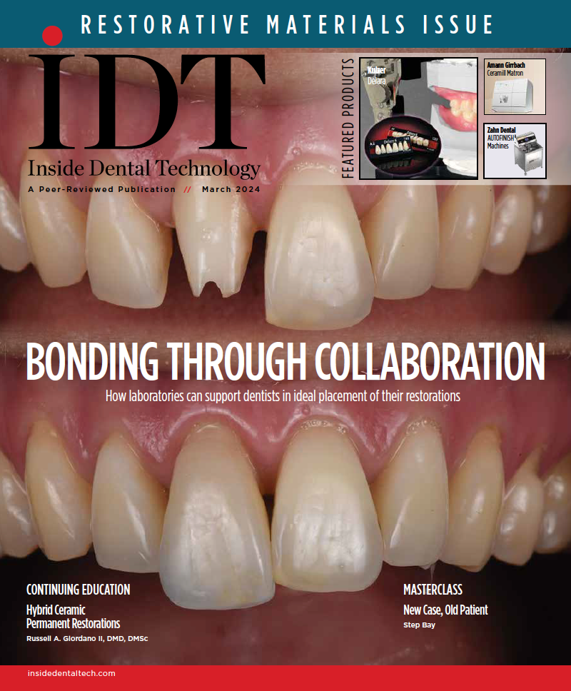 Bonding Through Collaboration | Inside Dental Technology