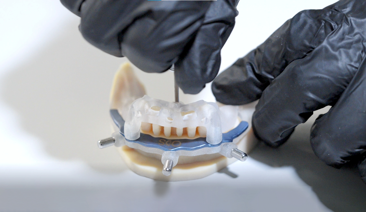 Stratasys DentaJet Series Building Momentum With Dental Labs Globally ...