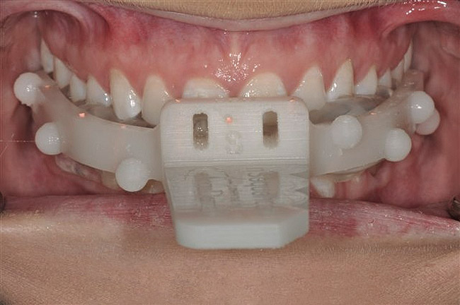 A New Breed | Inside Dental Technology