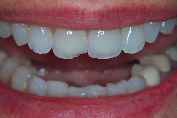 Harmony of Function, Balance of Responsibility | Inside Dental Technology