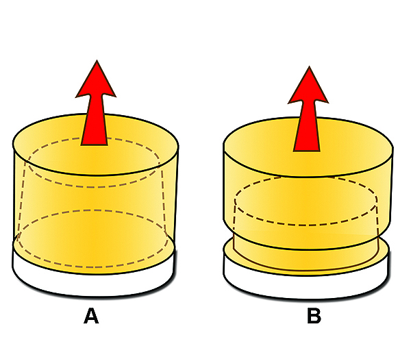 Tooth Preparation Theory: Application to Custom Abutment Design ...