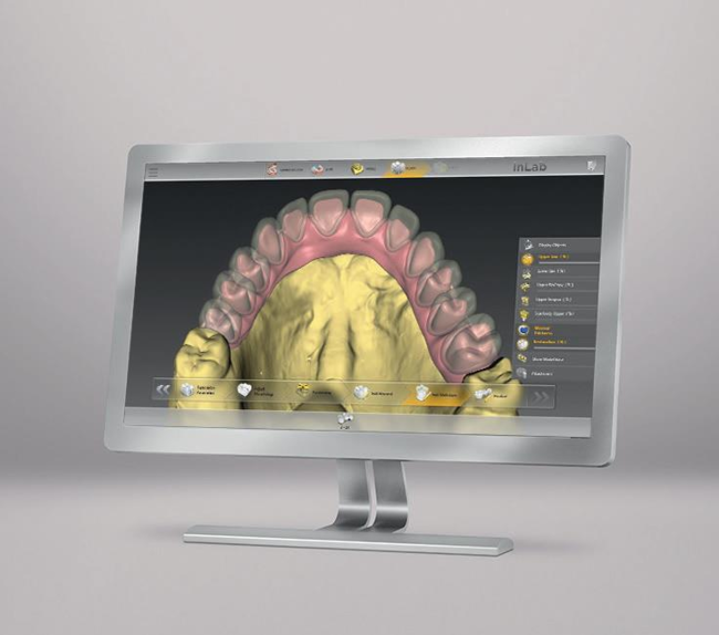 inLab SW 18.1 Updates Available | Inside Dental Technology