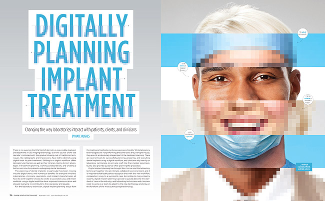 Digitally Planning Implant Treatment | Inside Dental Technology