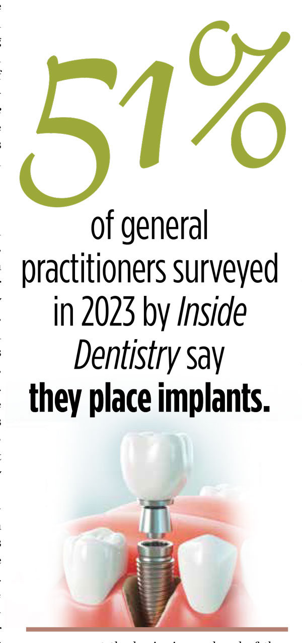 Implant Fundamentals | Inside Dental Technology