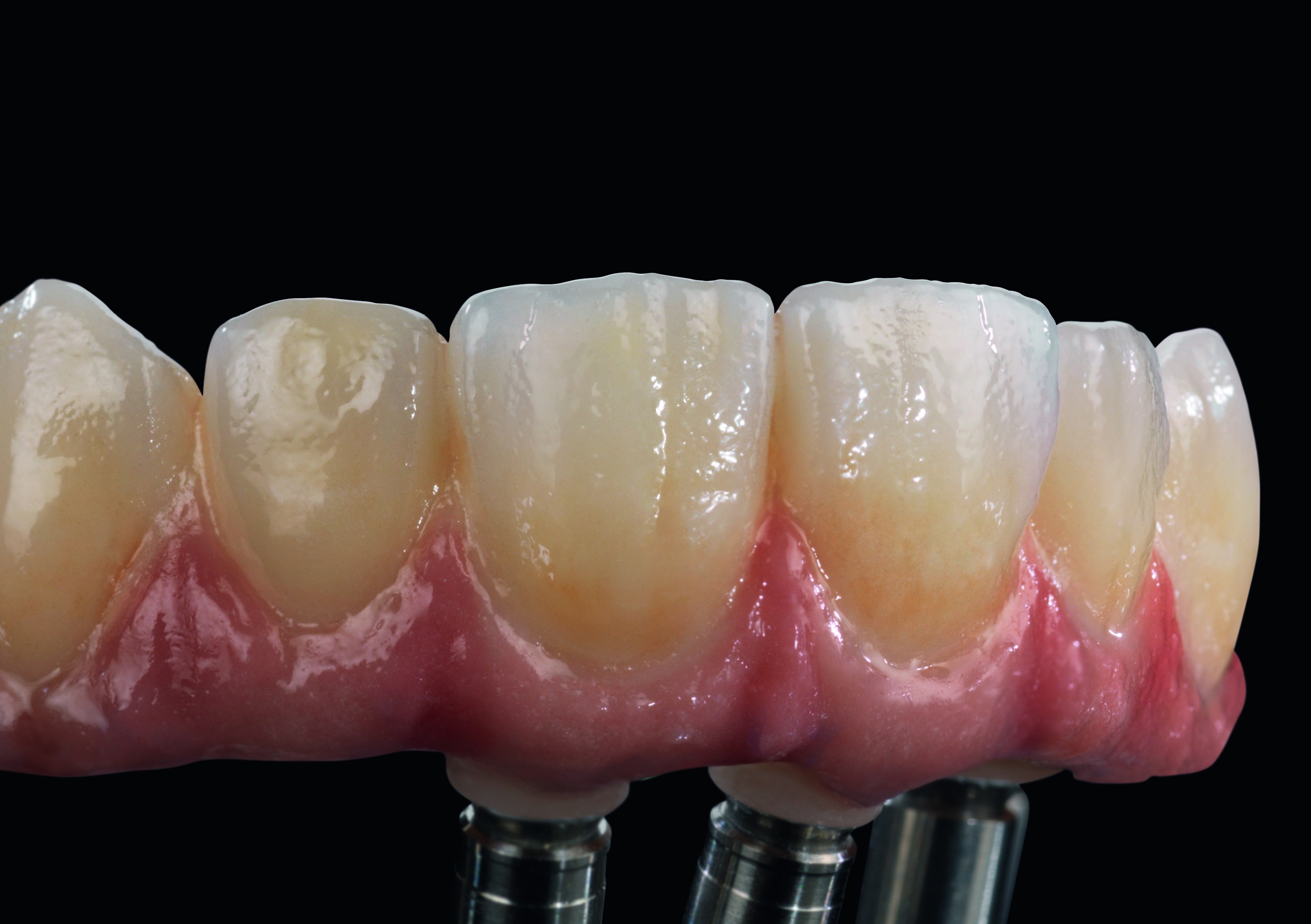 Zolid Zirconia Celebrates 10 Years: As successful as ever | Inside ...