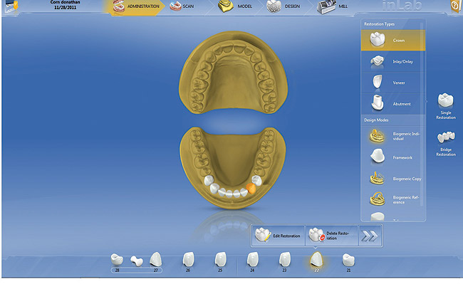Streamline your Workflow with inLab® Software 4.0 | Inside Dental ...
