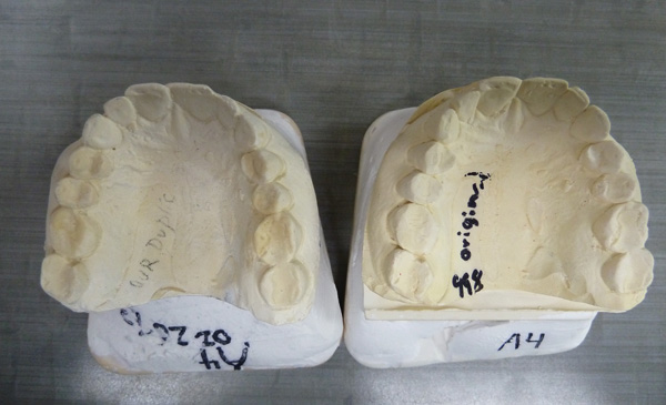 Perfecting the Smile with Proper Planning | Inside Dental Technology