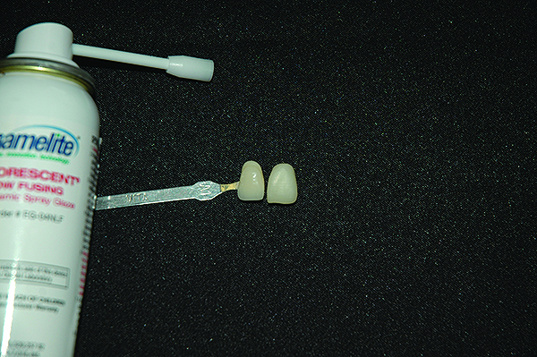 A Spray Glaze for All Purposes | Inside Dental Technology