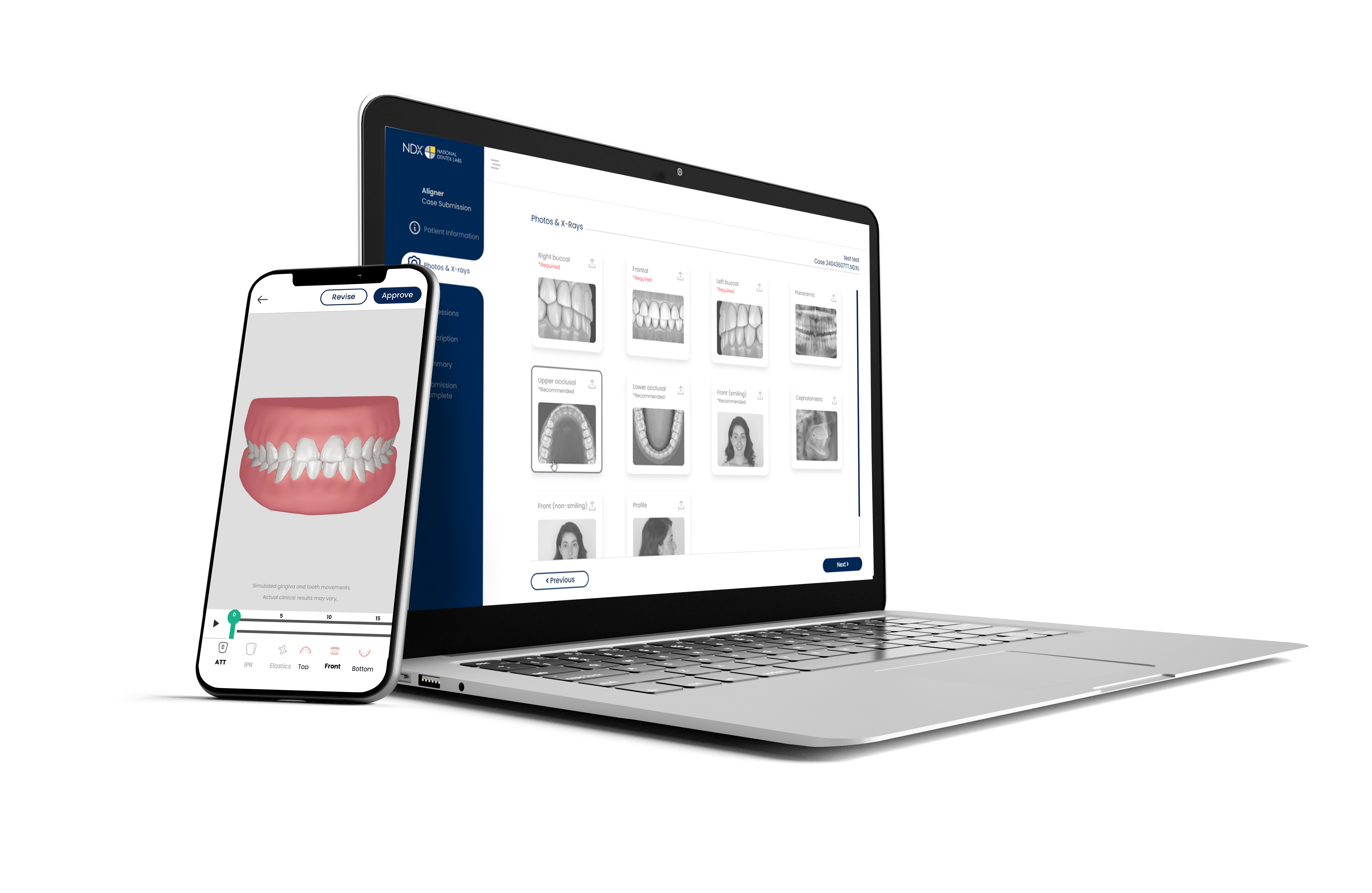 NDX Introduces NDX Aligners, an Innovative Orthodontic Solution for ...
