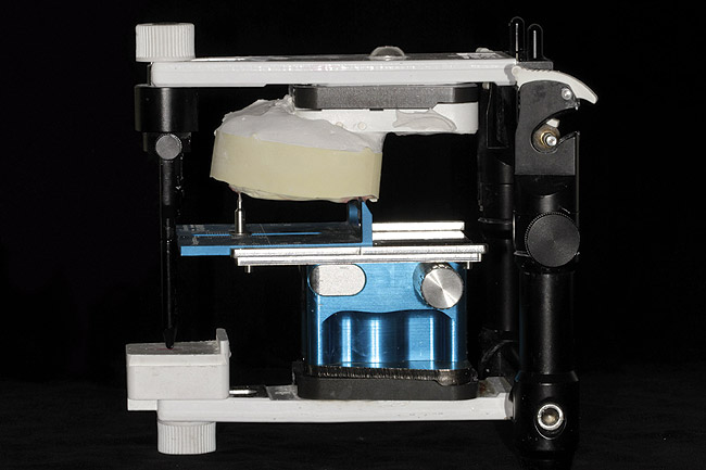 A Tooth for Every Case | Inside Dental Technology
