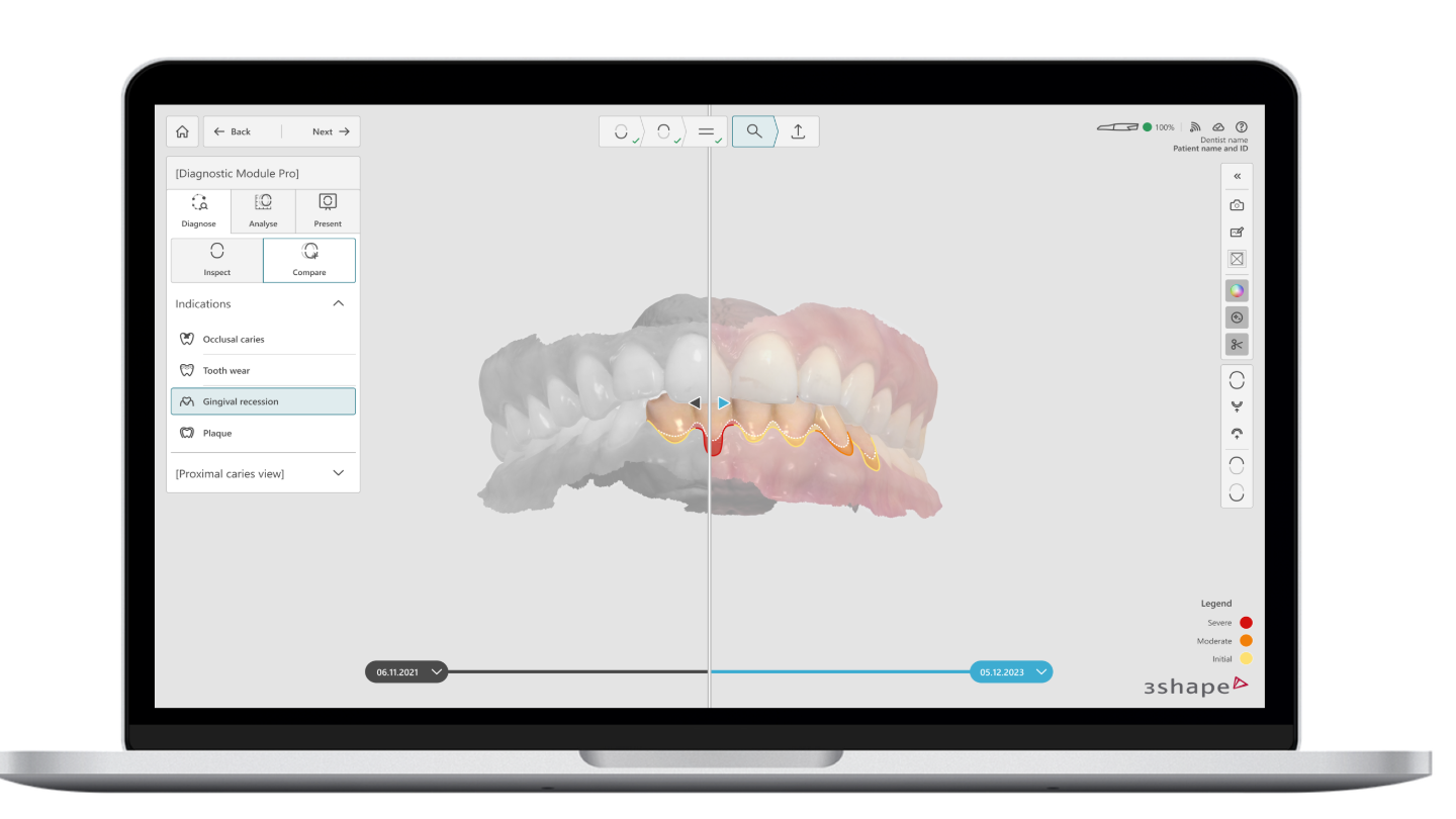 3Shape Secures FDA Clearance For Dx Software In United States | Inside ...